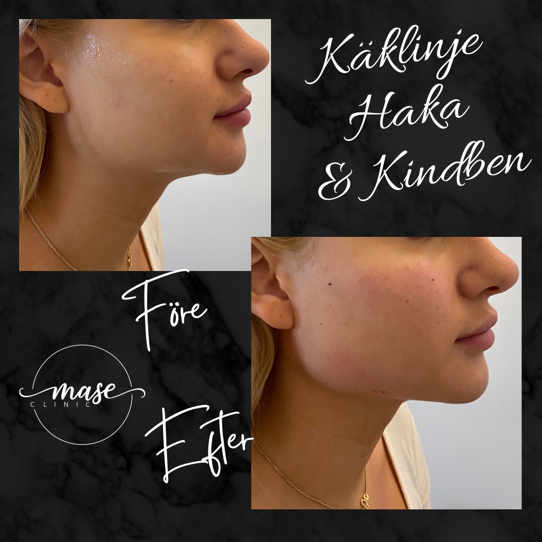 Mase Clinic, Stockholm - Bokadirekt
