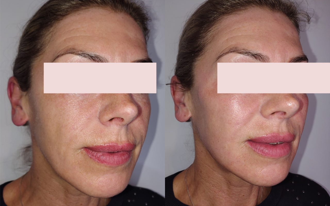 Elan Skin Clinic, Göteborg - Bokadirekt