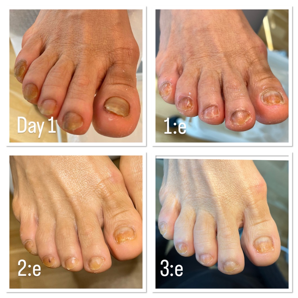 Pranari Massage & Medicinsk Fotvård by PD Nobelvägen 4, Malm