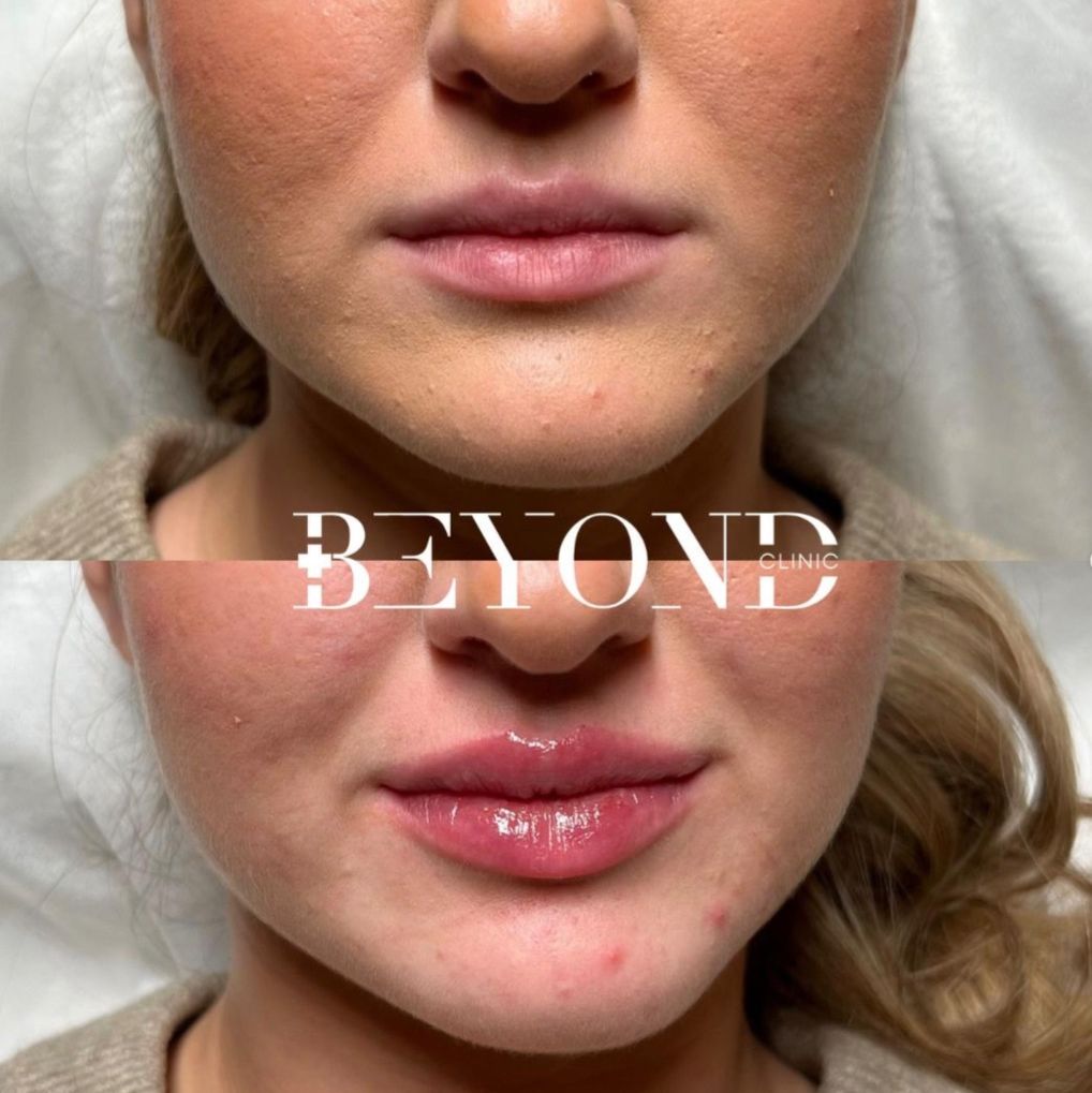 Beyond Clinic, Västerås - Bokadirekt