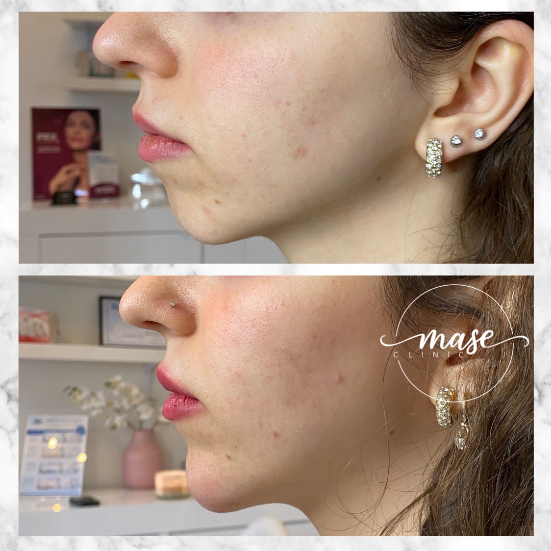 Mase Clinic, Stockholm - Bokadirekt