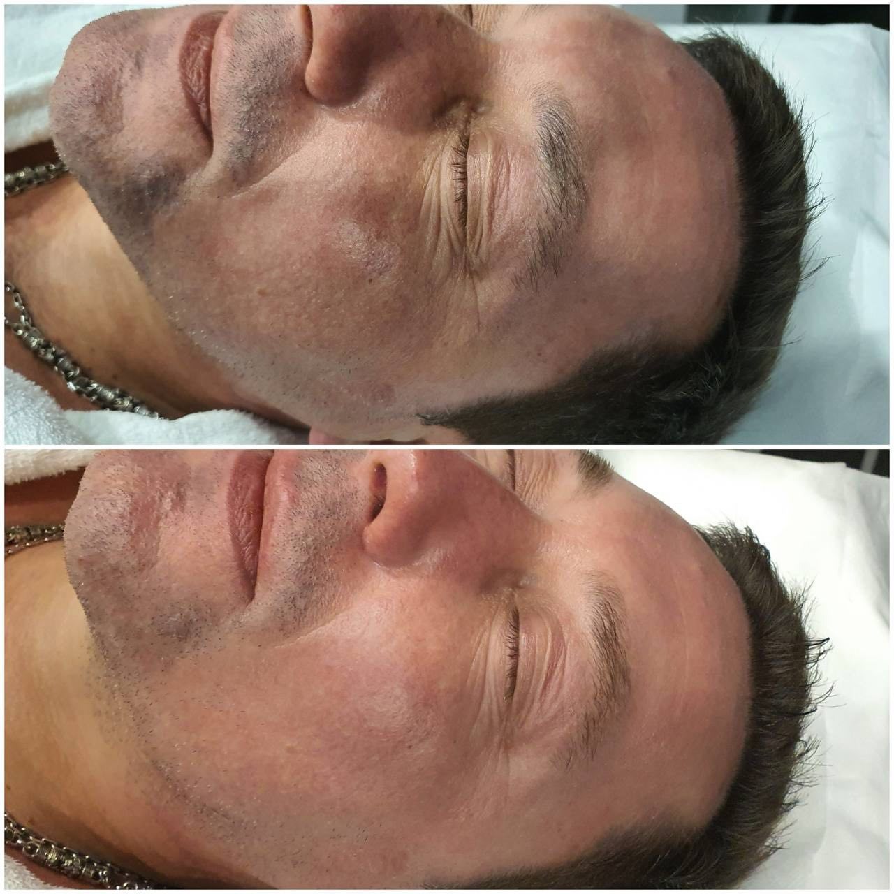 Elan Skin Clinic, Göteborg - Bokadirekt